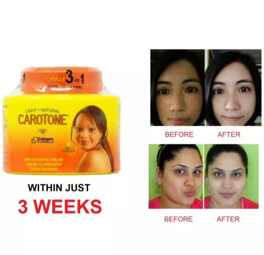 CAROTONE Cream 135 ML | Daraz.lk